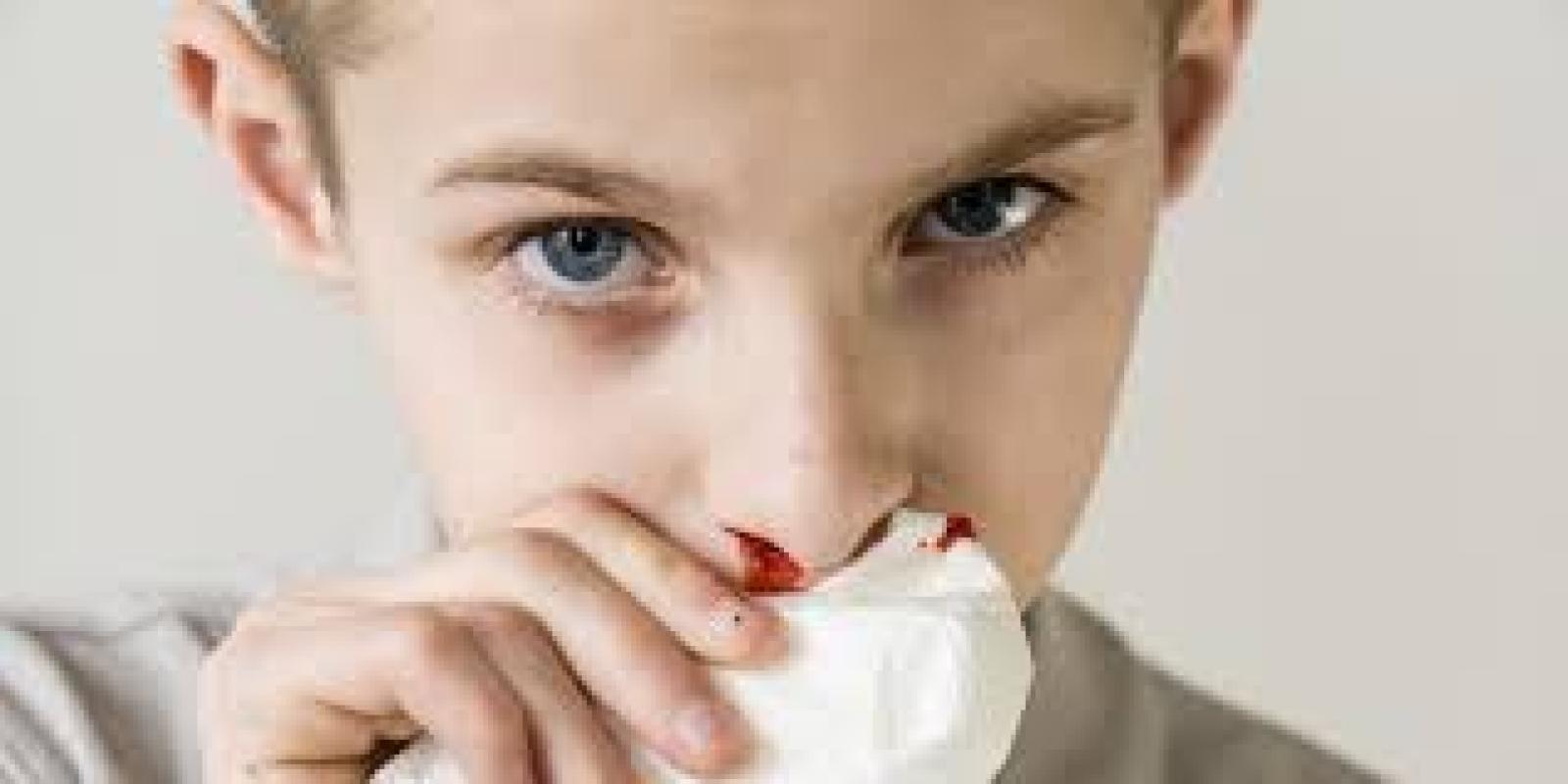 Sângerări nazale la copii, ce trebuie făcut în caz de epistaxis ...